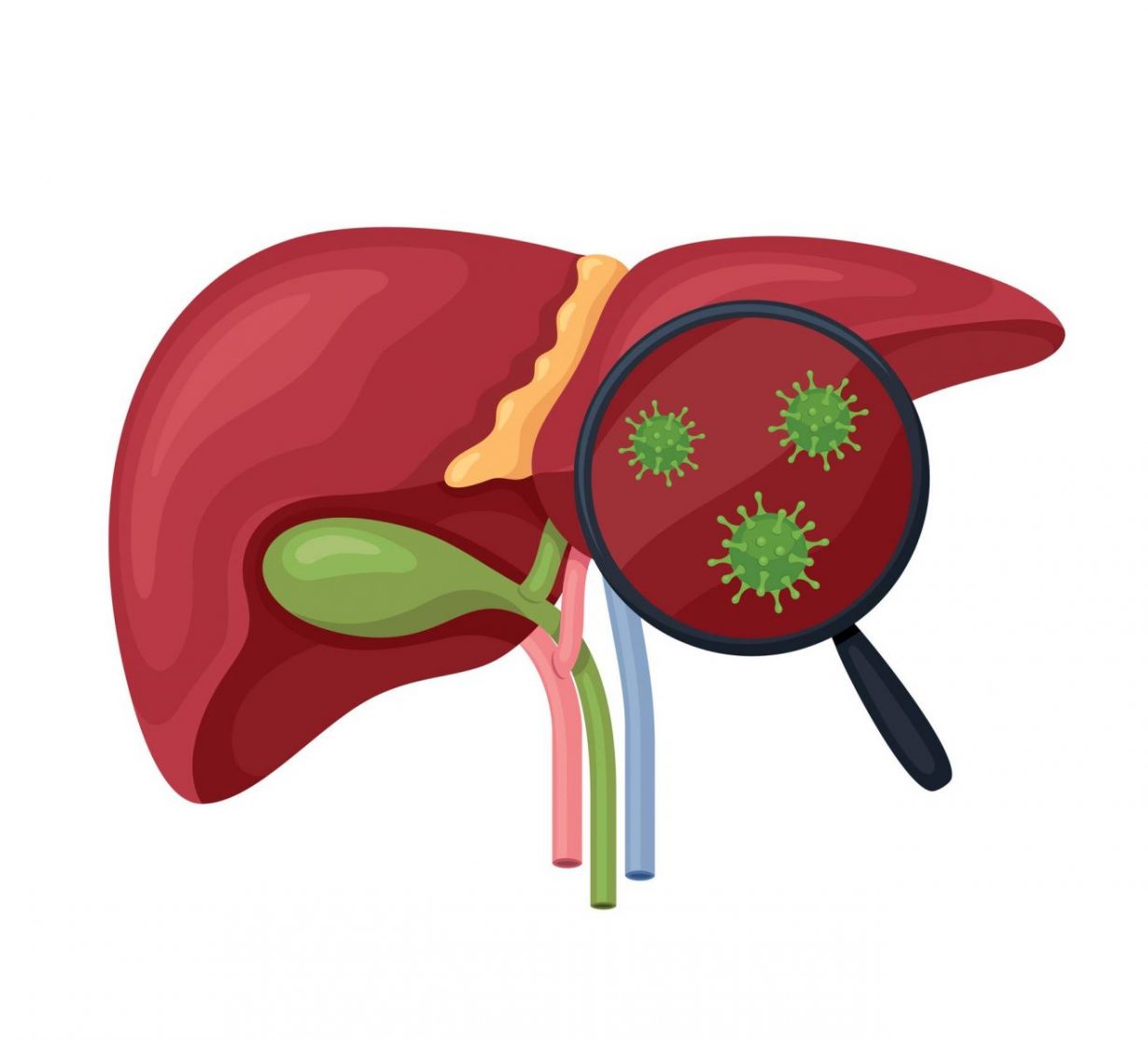 Hepatite A: características, diagnóstico e tratamento